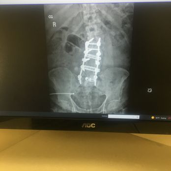 ERIK C SPAYDE, MD - Updated December 2025 - 18 Photos & 45 Reviews ...