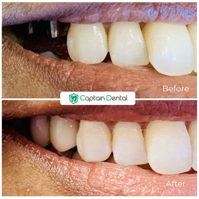 CAPTAIN DENTAL - Updated December 2025 - 34 Photos & 23 Reviews - 1690 ...