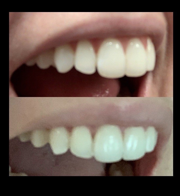 LATHAM GARY M DDS - Updated December 2025 - 36 Reviews - 1260 N Dutton ...