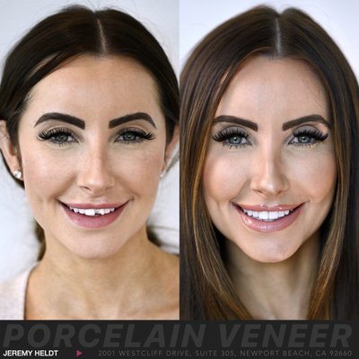 JEREMY HELDT, DDS - Updated December 2025 - 219 Photos & 104 Reviews ...