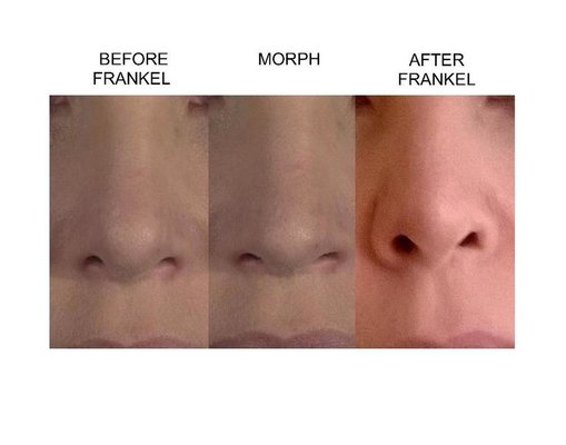 ANDREW S.FRANKEL,MD - Updated December 2025 - 35 Photos & 44 Reviews ...