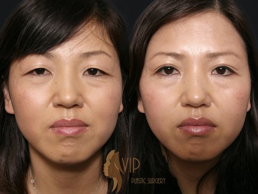 VIP PLASTIC SURGERY - Updated August 2025 - 112 Photos & 72 Reviews ...