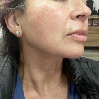 LILLY BEAUTY MEDICAL SPA - Updated July 2024 - 42 Photos & 64 Reviews ...