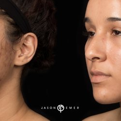 JASON EMER, MD - 914 Photos & 365 Reviews - Dermatologists - 9201 ...