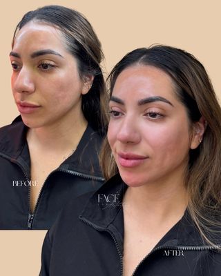 FACE LAB AESTHETICS - Updated February 2025 - 80 Photos & 35 Reviews ...