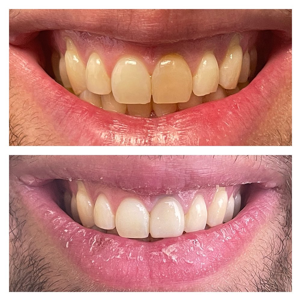 NIKI ZARABIAN, DDS - SHERMAN OAKS SMILE STUDIO - Updated October 2025 ...