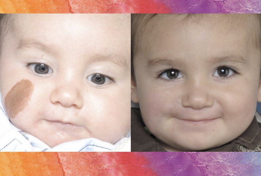 SHERYL LEWIN, MD - LEWIN EAR RECONSTRUCTION - Updated October 2025 - 11 ...