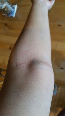 LABCORP - Updated December 2025 - 10 Photos & 23 Reviews - 307 Hamburg ...