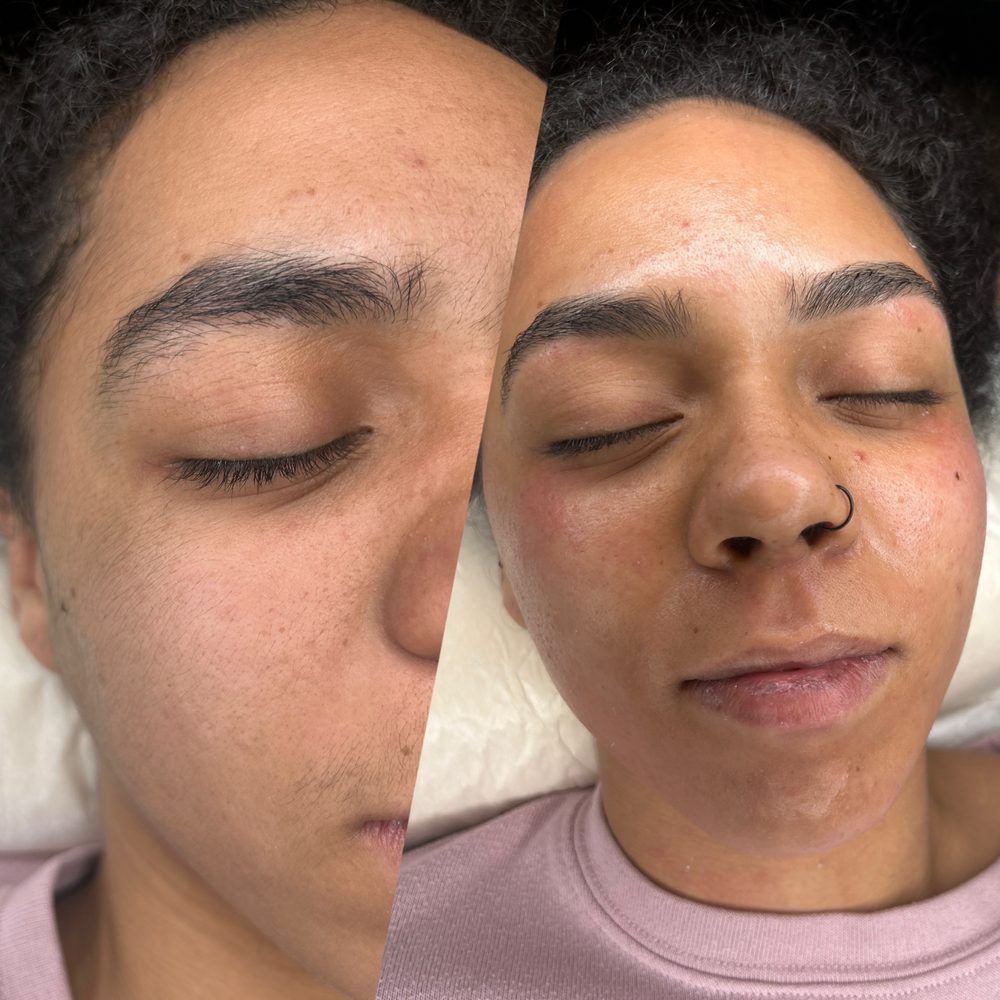 ACE AESTHETICS - Updated August 2025 - 4230 Lyndon B Johnson Fwy ...