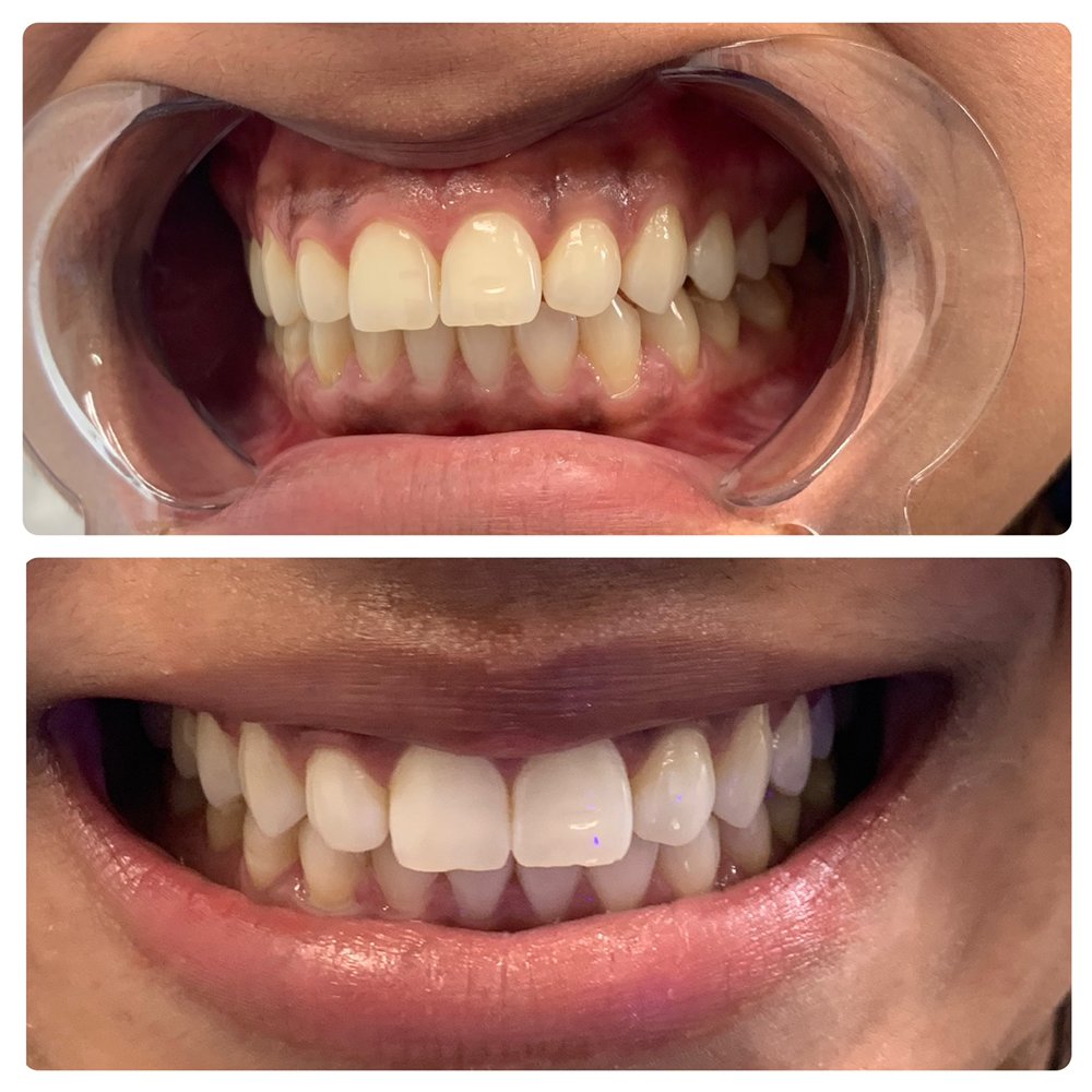 GLEAM AND GLAM TEETH WHITENING & AESTHETICS - 10 Photos - 7075 Fm 1960 ...