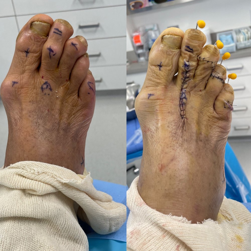 BEN TEHRANI, DPM - KINGS POINT FOOT & ANKLE - Updated July 2025 - 16 ...