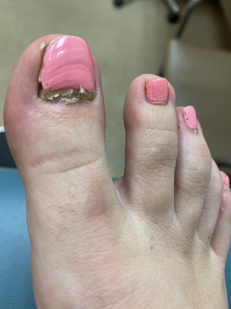 NEW YORK NAILS - Updated December 2024 - 75 Photos & 25 Reviews - 5607 ...