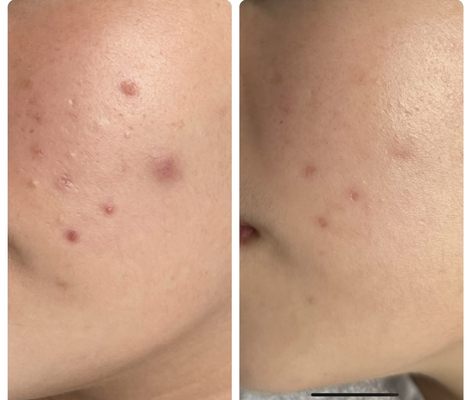 UNBLEMISHED SKIN STUDIO - Updated December 2025 - 100 Photos & 15 ...