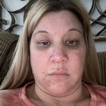 SUGENE KIM, MD FACS - SGK PLASTIC SURGERY - Updated September 2025 - 17 ...