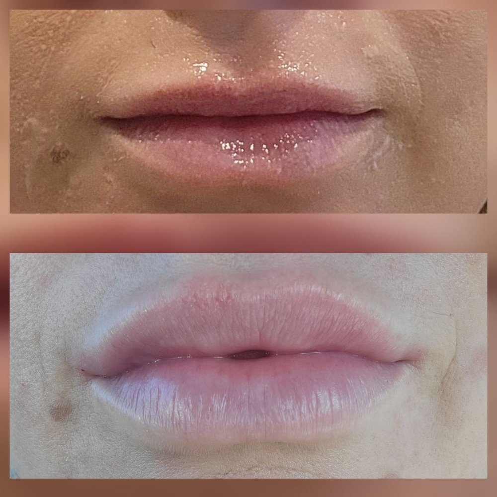 THE PLASTIC SURGERY CENTER - Updated July 2025 - 29 Reviews - 8723 ...