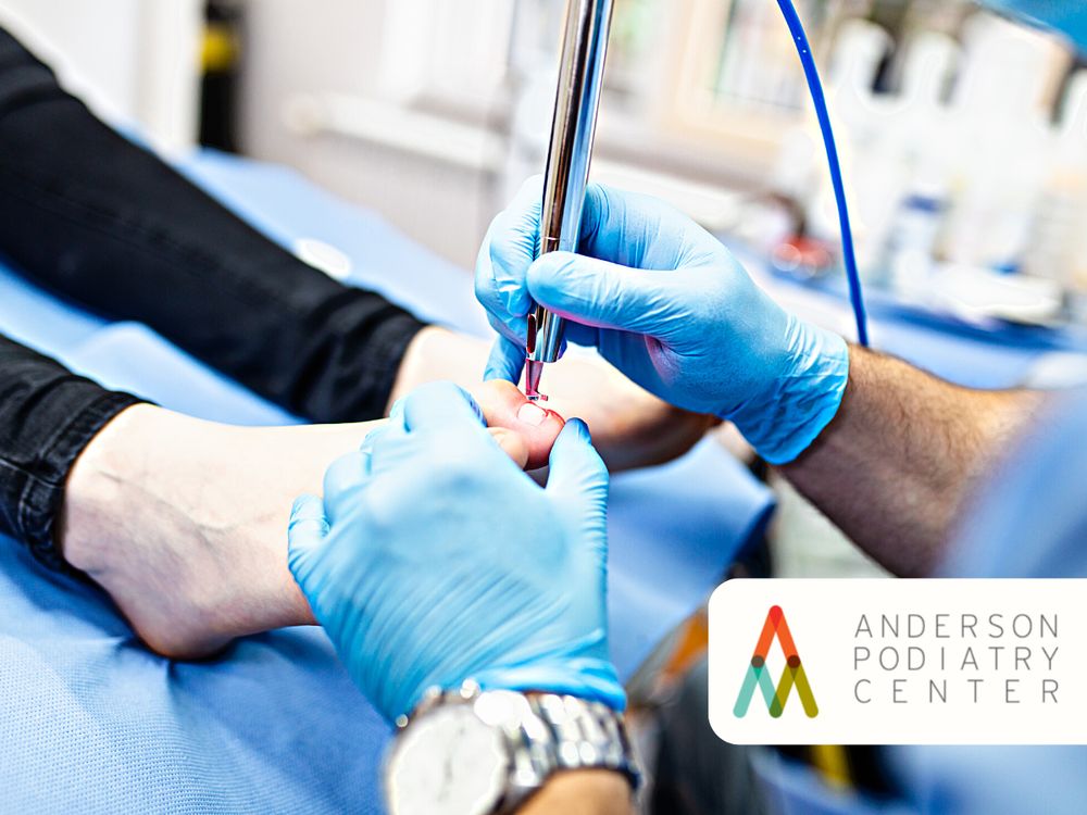 ANDERSON PODIATRY CENTER - Updated April 2024 - 27 Photos & 21 Reviews ...