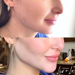 ALCHEMY FACE BAR - Updated July 2025 - Request an Appointment - 5000 E ...