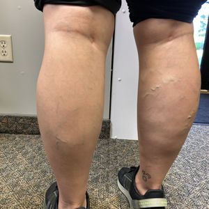 DERBY DERM - Updated December 2025 - 1121 N College Park St, Derby ...