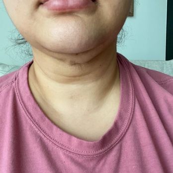 PAUL S THESIGER, MD - THESIGER PLASTIC SURGERY - Updated December 2025 ...