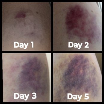 WALGREENS - Updated December 2025 - 20 Reviews - 2001 W Granada Blvd ...