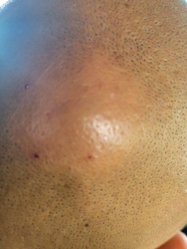 WEST DERMATOLOGY - CHULA VISTA - 2300 Boswell Rd, Chula Vista ...