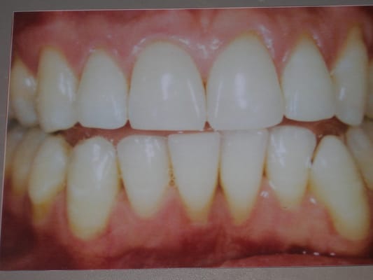 MARTIN CHEE, DDS - Updated August 2025 - 30 Photos & 30 Reviews - 500 ...