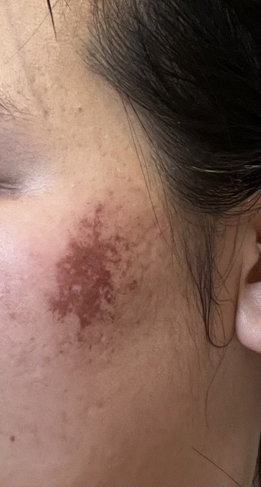 SURINDER SANDHU, MD - NEW IMAGE MEDICAL SPA - Updated December 2025 - 36 Photos & 69 Reviews ...