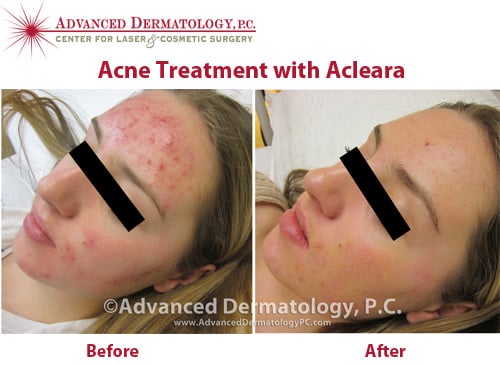 ADVANCED DERMATOLOGY - Updated October 2025 - 43 Reviews - 4 Technology ...