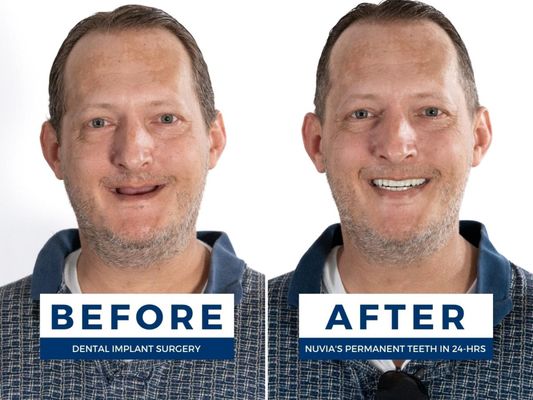 NUVIA DENTAL IMPLANT CENTER - Updated January 2026 - 42 Photos - 3101 ...