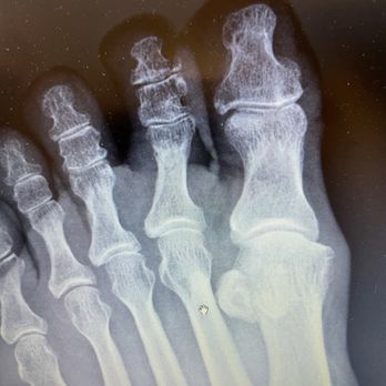 ROC EXPRESS - Updated November 2025 - 43 Photos & 95 Reviews - 555 N ...