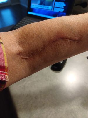 ADVANCED PAIN CARE - CENTRAL AUSTIN - Updated May 2026 - 16 Photos & 73 ...