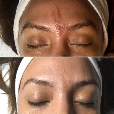 DERMALASER MED SPA - Updated October 2025 - 67 Photos & 29 Reviews ...