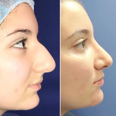 JEREMY NIKFARJAM, MD - NEW YOU PLASTIC SURGERY - Updated December 2025 ...