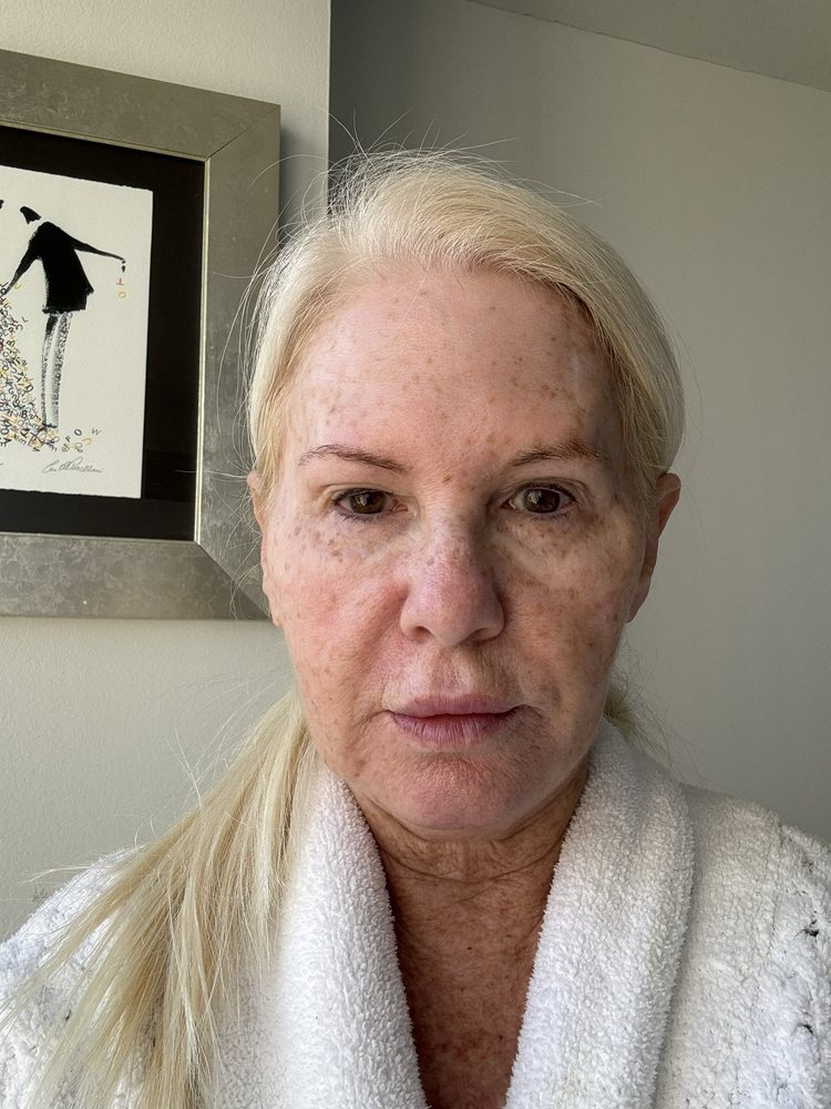 DAVID J APPLEBAUM, MD FACS - Updated October 2025 - 15 Reviews - 1599 ...