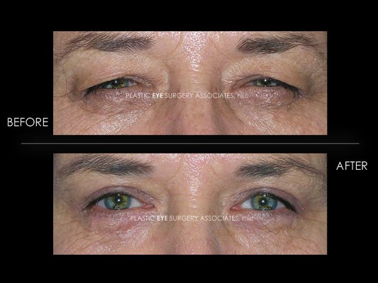 PLASTIC EYE SURGERY ASSOCIATES - Updated December 2025 - 52 Photos & 13 ...