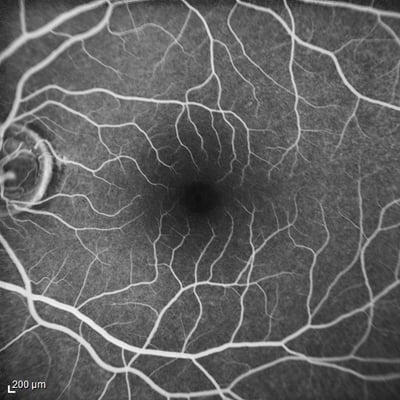 RETINA MACULA CONSULTANTS OF CALIFORNIA - Updated December 2025 - 13 ...