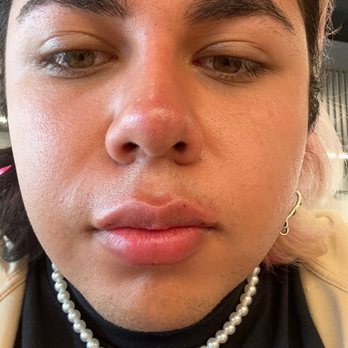 BRETT STOMPRO, MD & CHESTER CHENG, MD - Updated June 2024 - 245 Photos ...