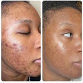 COLLER J OCHSNER, MD - Updated August 2025 - 16 Reviews - 2323 Metairie ...