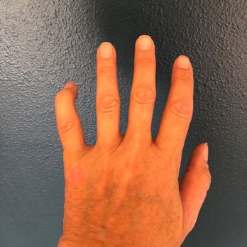 HAND CENTER OF NEVADA - Updated December 2025 - 29 Photos & 85 Reviews ...