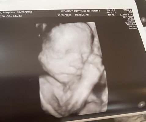 ATRIUM HEALTH - CABARRUS - Updated October 2025 - 57 Photos & 72 ...