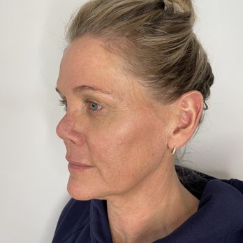 DRMICHAELKIM FACIAL PLASTIC SURGERY - Updated January 2026 - 45 Photos ...