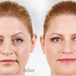 TAL DAGAN, MD, FACS - 22 Photos & 73 Reviews - 420 Madison Ave, New ...