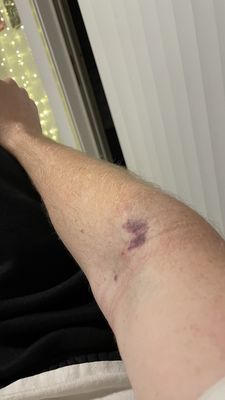 BIOLIFE PLASMA SERVICES - Updated May 2026 - 35 Photos & 64 Reviews ...