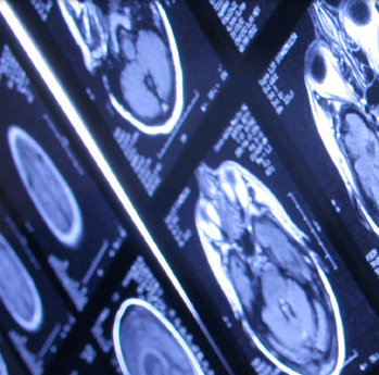 DR DEVIN BINDER - Updated January 2026 - 14 Photos & 72 Reviews - 9940 ...