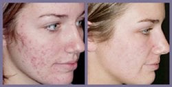 ADVANCED DERMATOLOGY - Updated October 2025 - 14 Photos & 64 Reviews ...