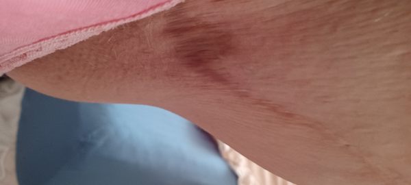 TULSA SURGICAL ARTS - Updated December 2025 - 17 Photos & 23 Reviews ...