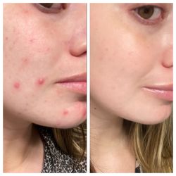 SAND DERMATOLOGY - 58 Photos & 132 Reviews - 3110 Chino Ave, Chino ...