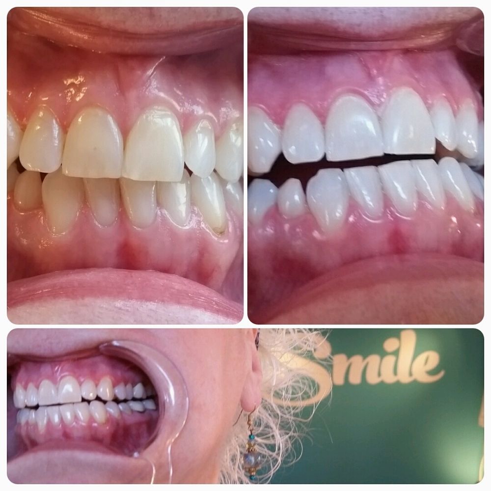 SMILE LABS PDX - 30 Photos & 44 Reviews - 3215 NE Broadway St, Portland ...