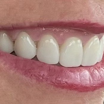 LOPEZ DENTAL ASSOCIATES - Updated December 2025 - 10 Photos - 6941 W ...