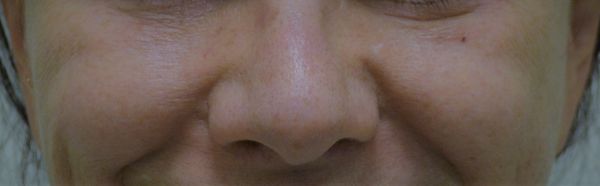 ALEX RABINOVICH, DDS MD - Updated October 2025 - 11 Photos & 304 ...